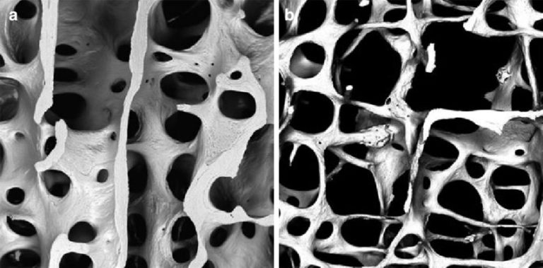 Metabolic Bone Disease in Bearded Dragons - What it is and What to do ...
